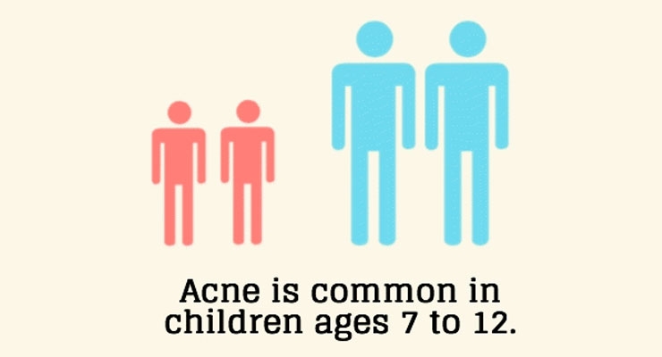 The Age for Acne | Happi