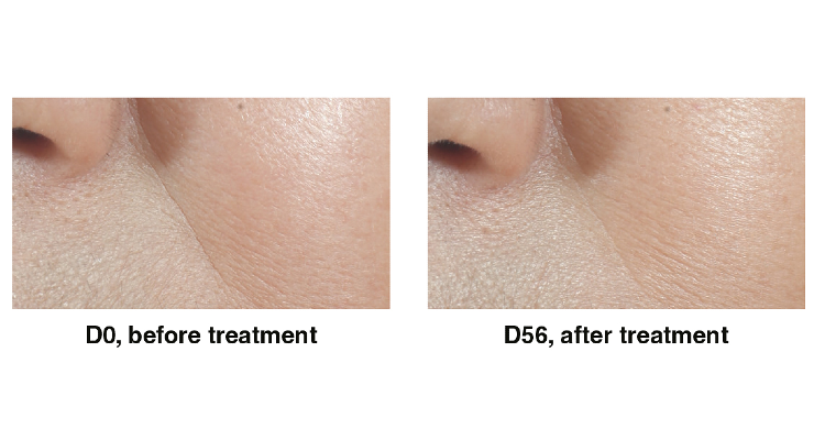 Silab Launches Erisium | Happi